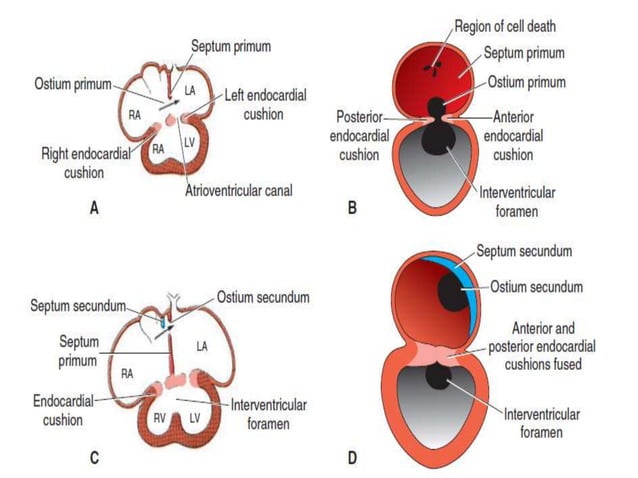 Interior of right atrium | PPTX | Heart and Cardiovascular Diseases ...