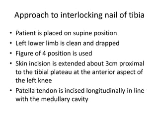 Interlocking nail of tibia | PPTX