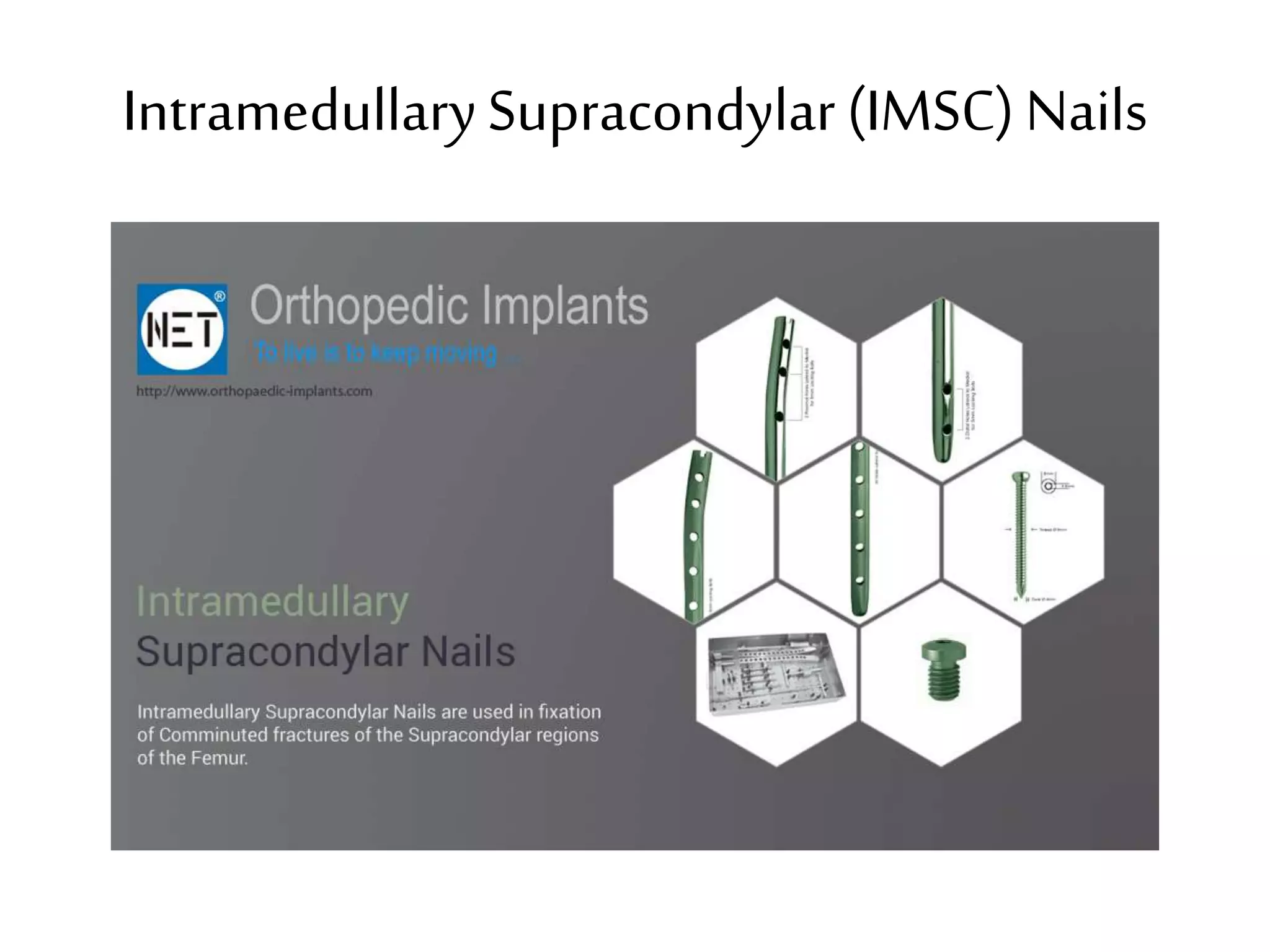 Interlocking Nails are used to fix the fractures of long bones. These ...