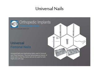 Interlocking Nails are used to fix the fractures of long bones. These ...