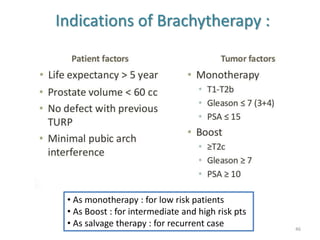 Intermediate and high risk prostate cancer | PPTX
