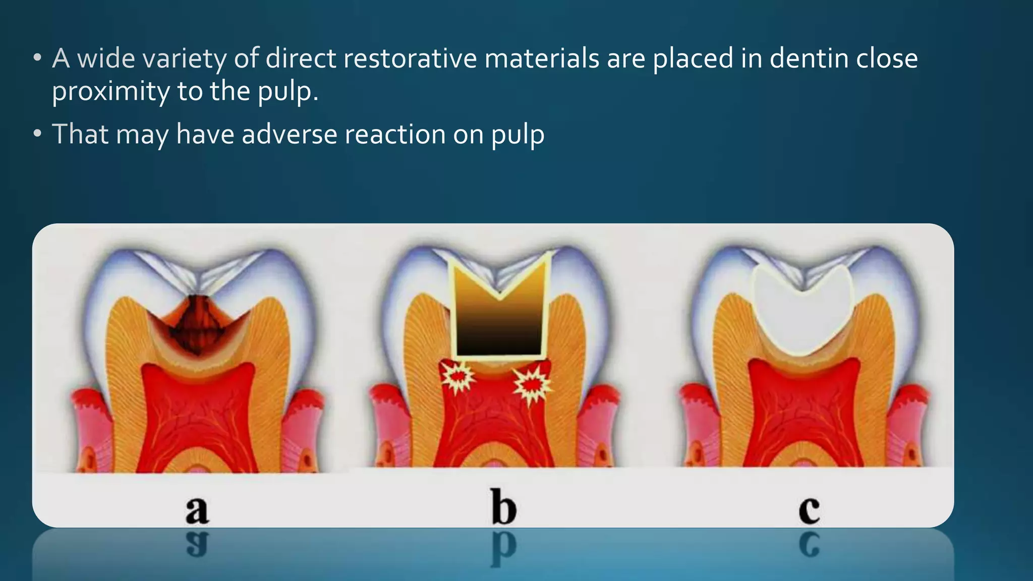 Intermediate restorative material (Dentistry) | PPTX