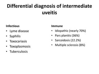 Intermediate uveitis | PPTX