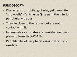 Intermediate uveitis | PPTX