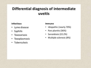 Intermediate uveitis | PPTX