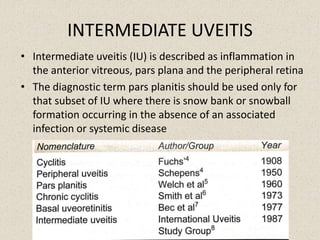 Intermediate uveitis | PPTX