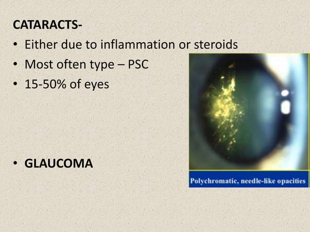 Intermediate uveitis | PPT