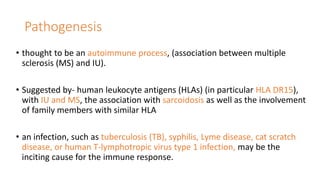 Intermediate uveitis.pptx