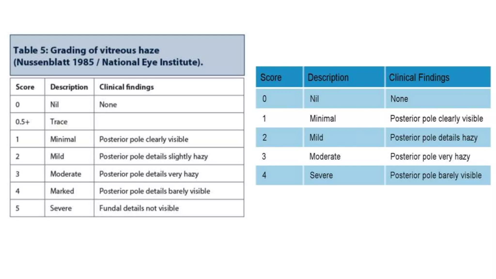 Intermediate Uveitis.pptx