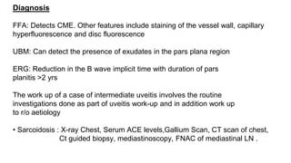 Intermediate Uveitis.pptx