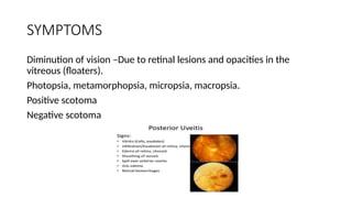 INTERMEDIATE UVEITISisaopthalmology.pptx