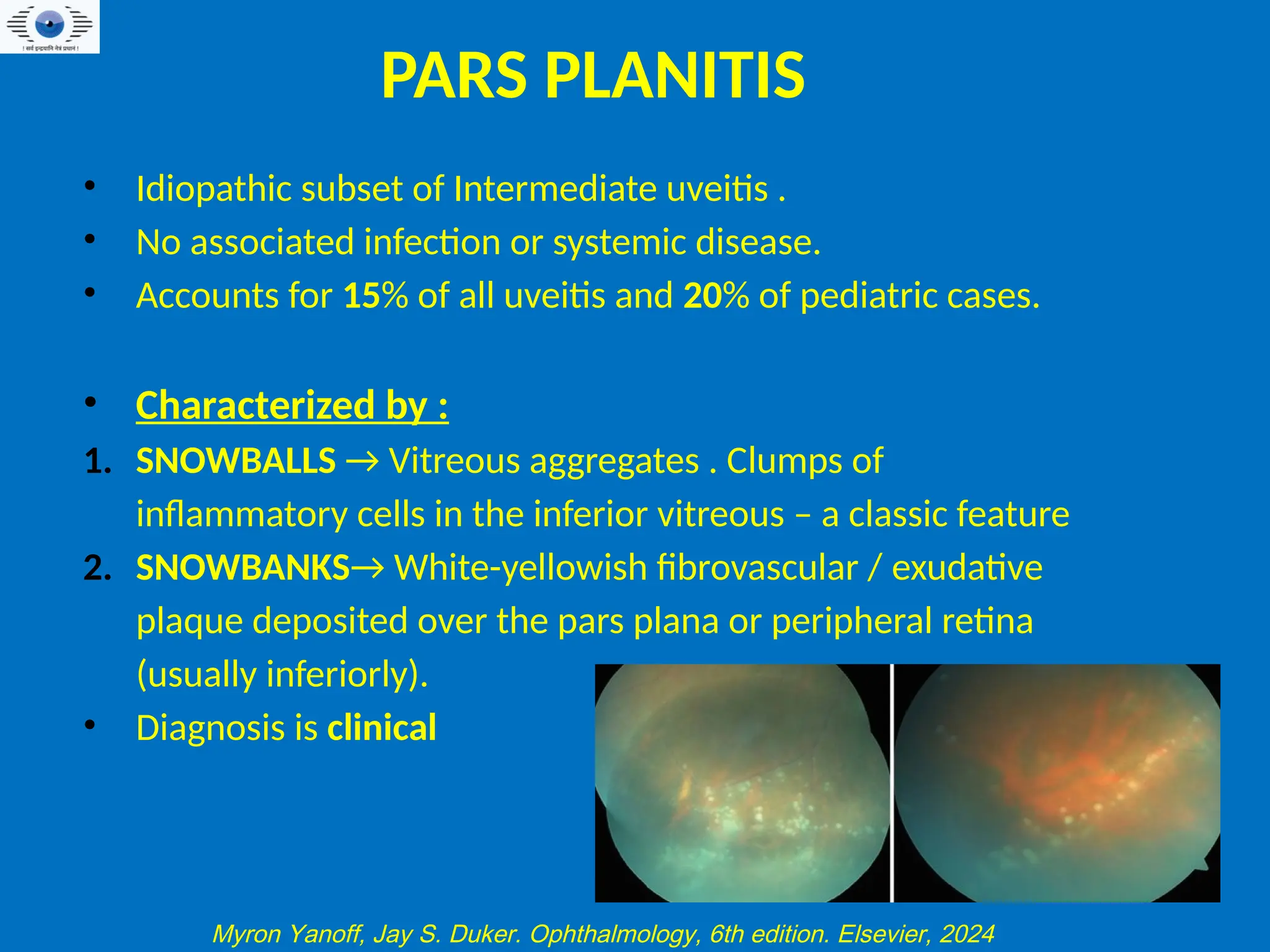 INTERMEDIATE UVEITIS , CLINICAL FEATURES , MANAGEMENT | PPTX