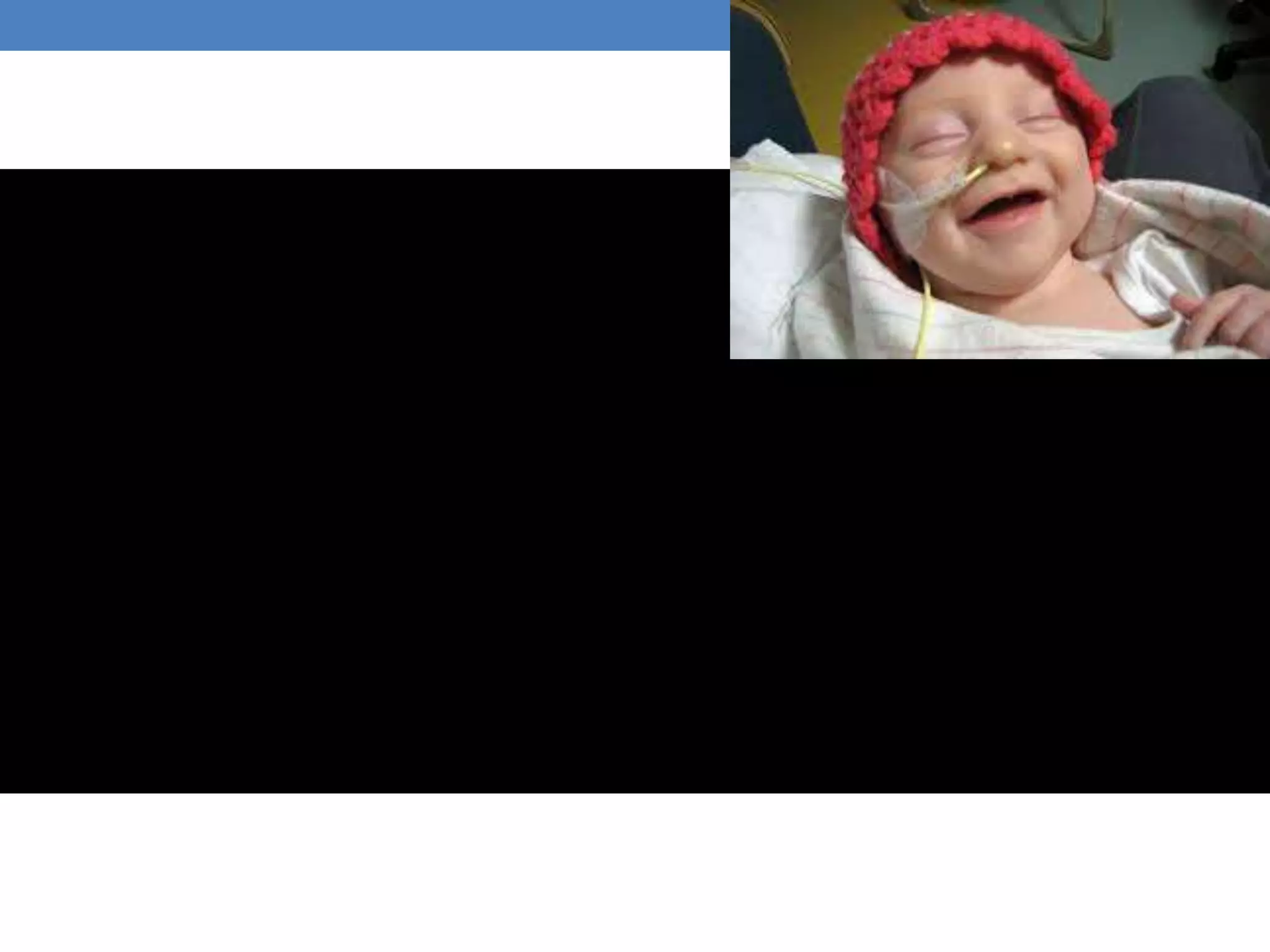 Intermittent bolus feeding versus continuous enteral feeding | PPTX