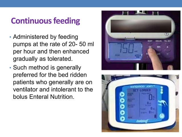 Intermittent bolus feeding versus continuous enteral feeding | PPT Intermittent bolus feeding versus continuous enteral feeding | PPT