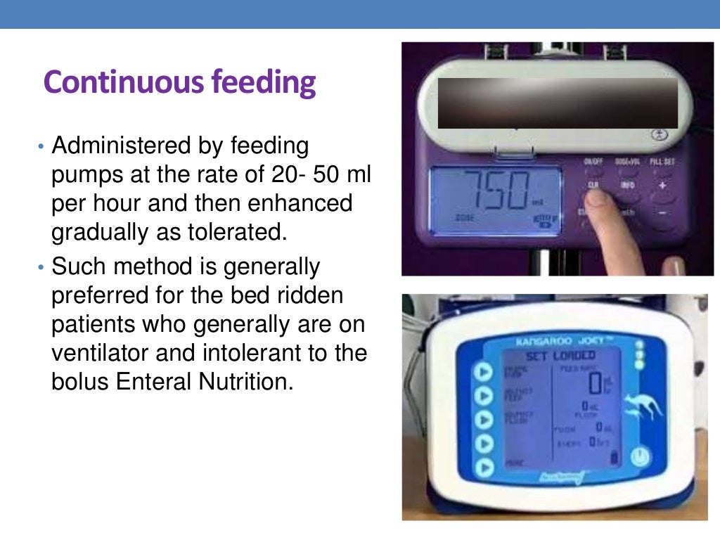 Intermittent Bolus Feeding Versus Continuous Enteral Feeding