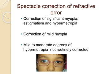 Intermittent exotropia | PPTX