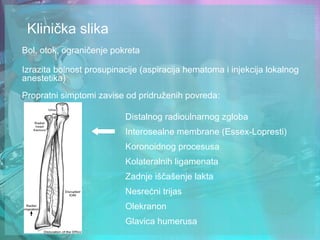 Prelom glave žbične kost | PPT
