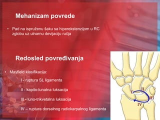 Luksacije lunatne kosti | PPT