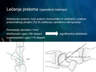 Prelom skafoidne kosti | PPT