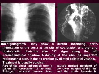 -Arterial Hypertension- | DOC