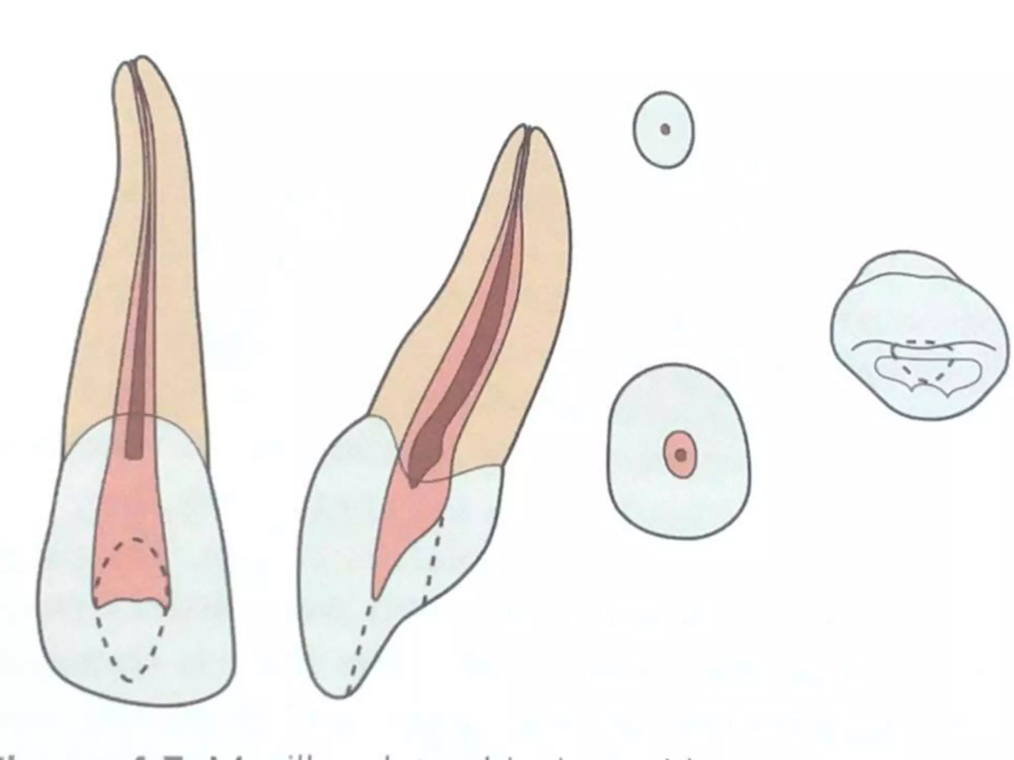 Internal anatomy of anterior tooth | PPTX