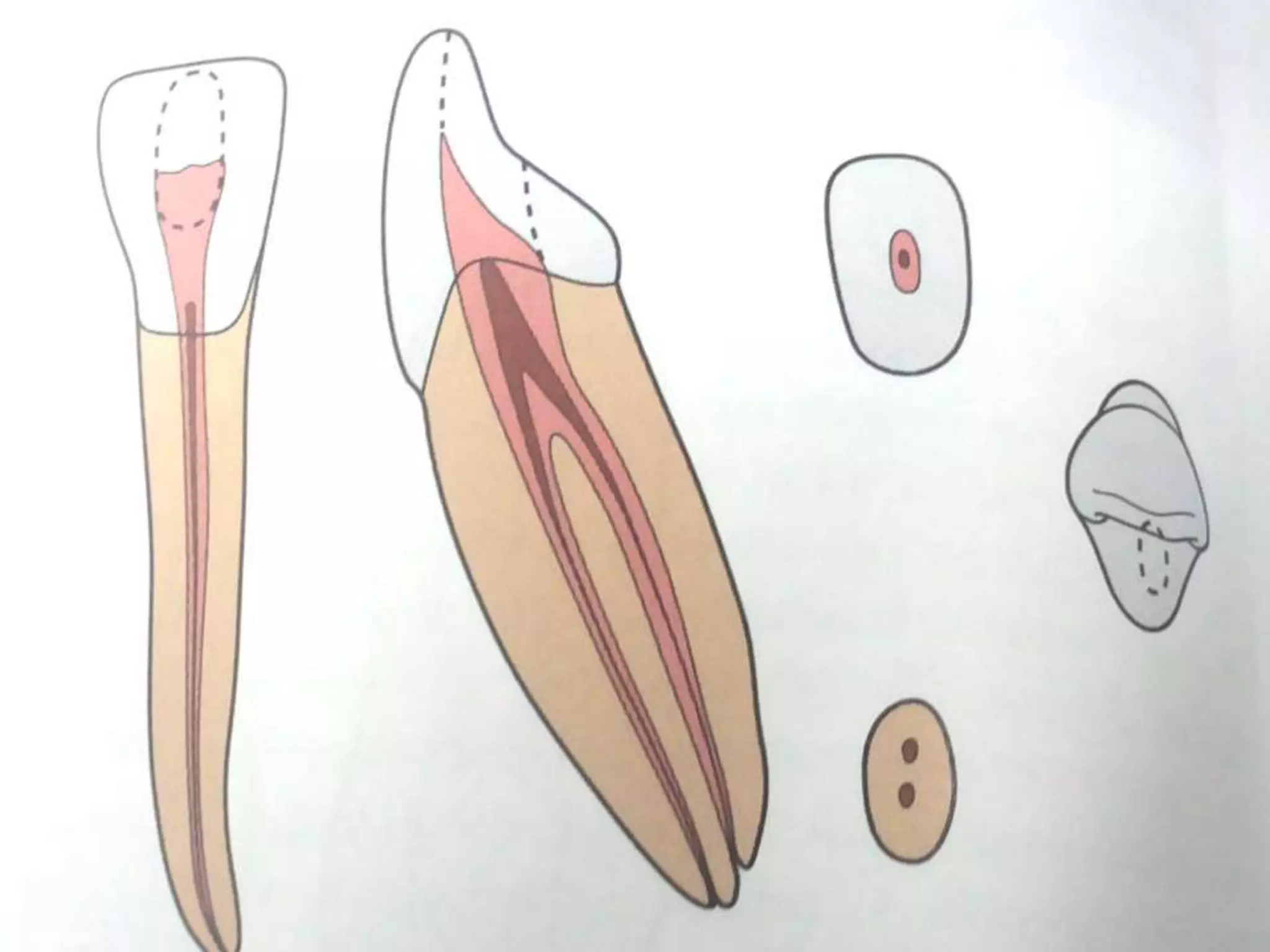 Internal anatomy of anterior tooth | PPTX