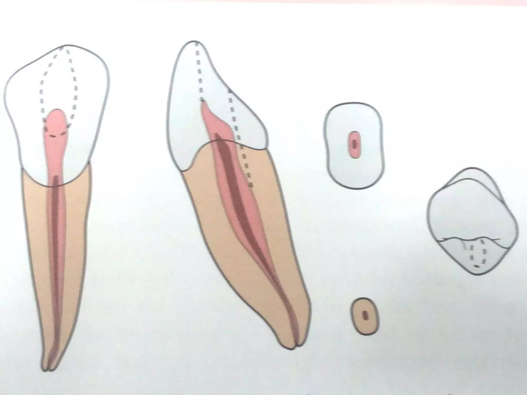 Internal anatomy of anterior tooth | PPTX