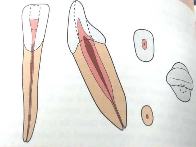 Internal anatomy of anterior tooth