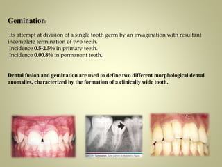Internal anatomy of tooth | PPTX