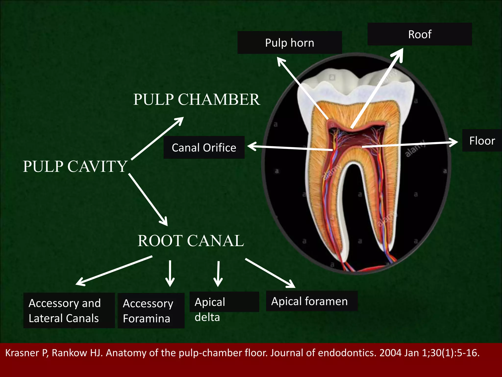 Internal anatomy of pulp space | PPT | Dental Health | Diseases and ...
