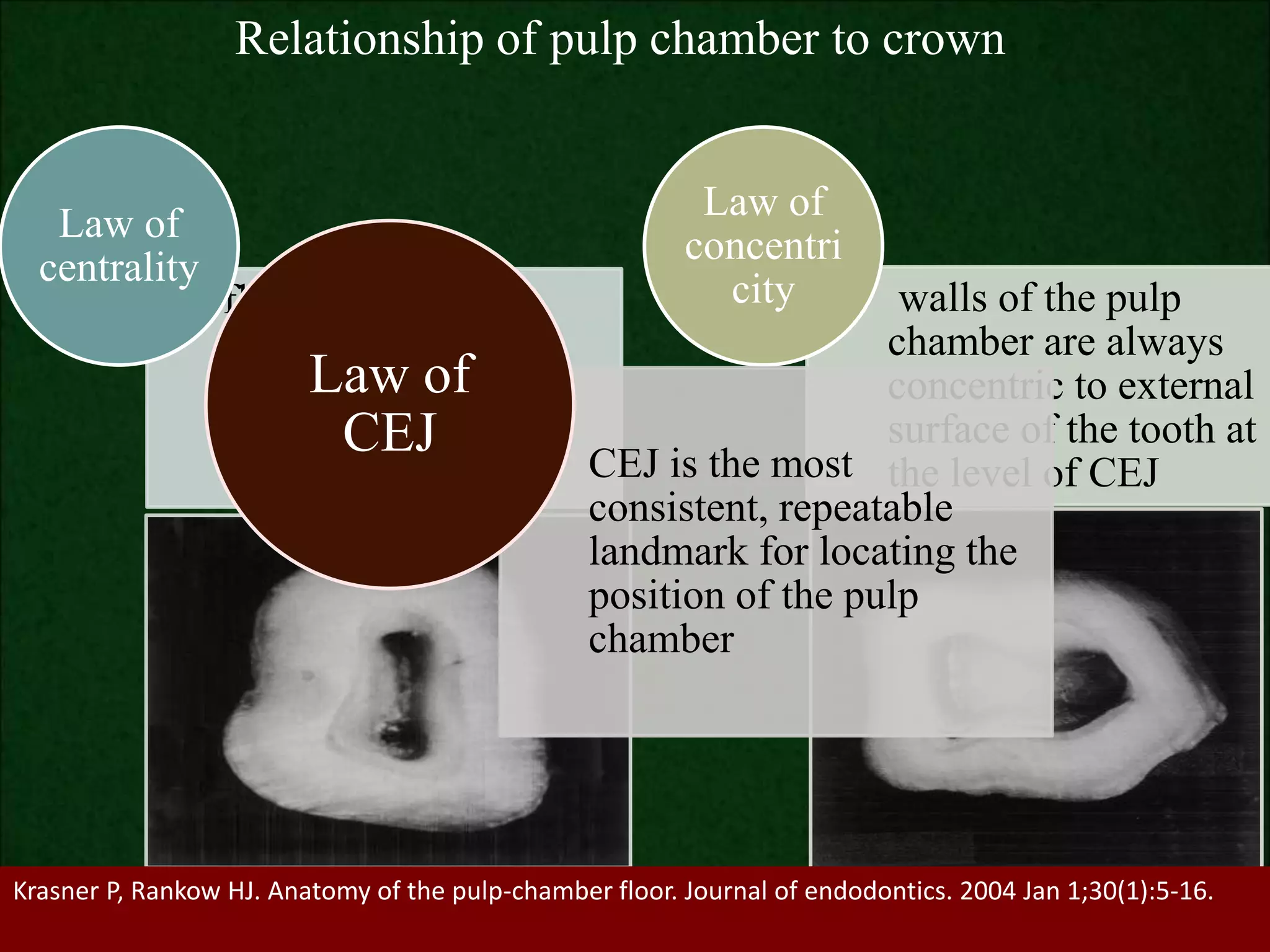 Internal anatomy of pulp space | PPT