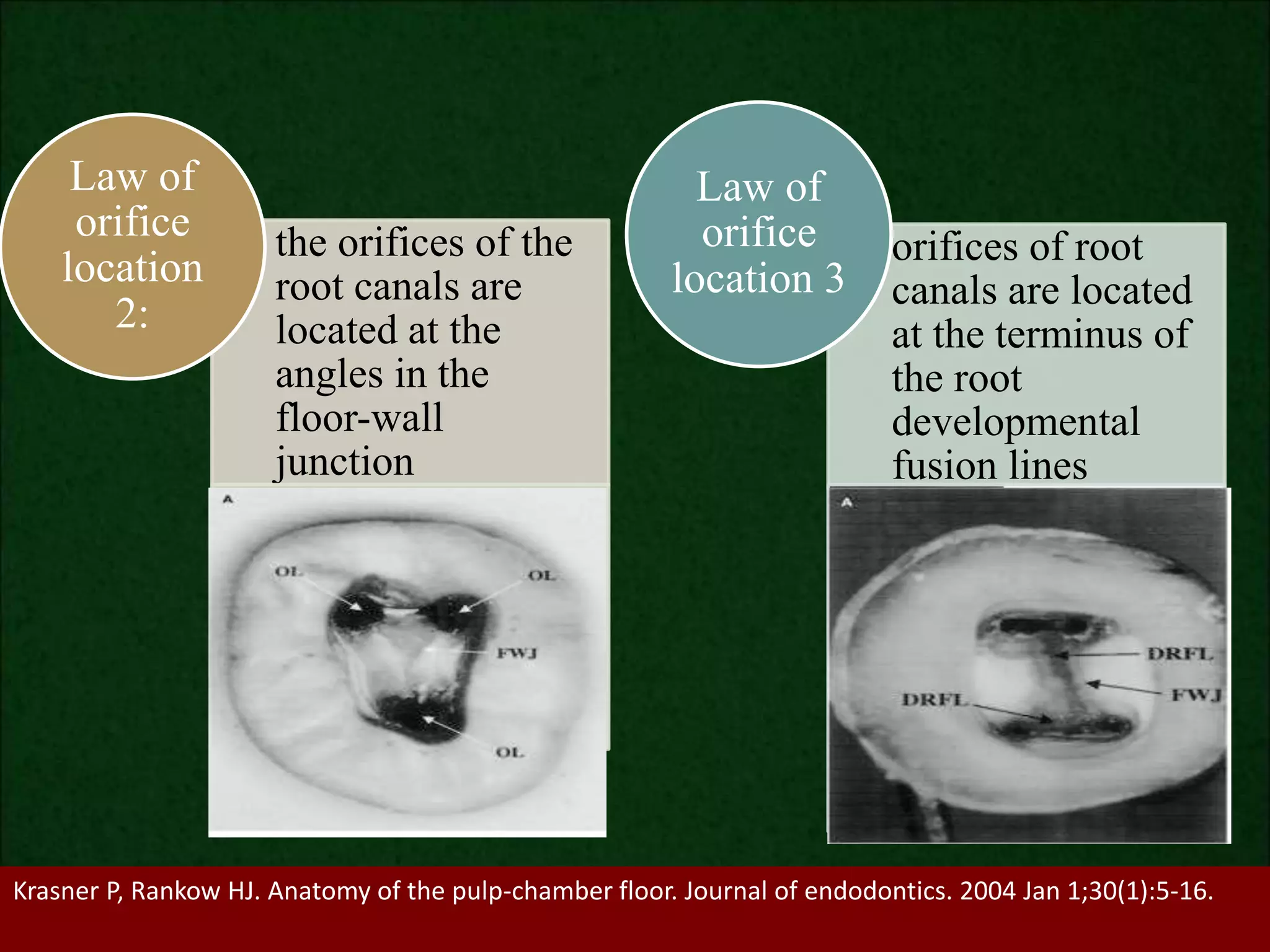Internal anatomy of pulp space | PPT | Dental Health | Diseases and ...