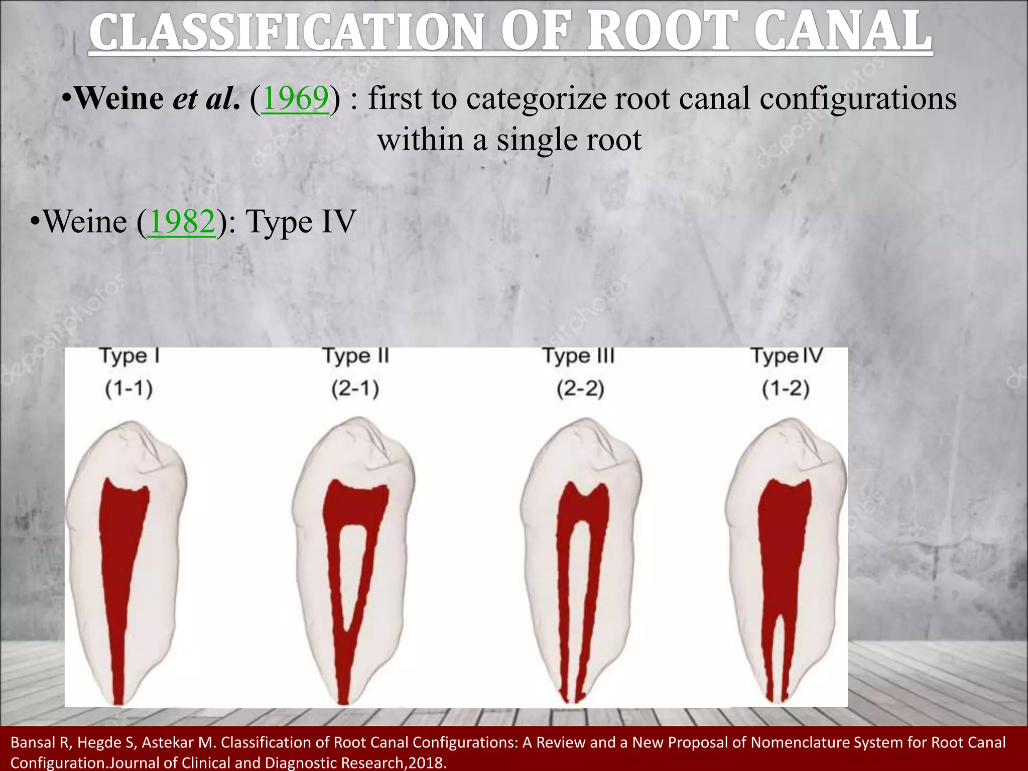 Internal anatomy of pulp space | PPT | Dental Health | Diseases and ...