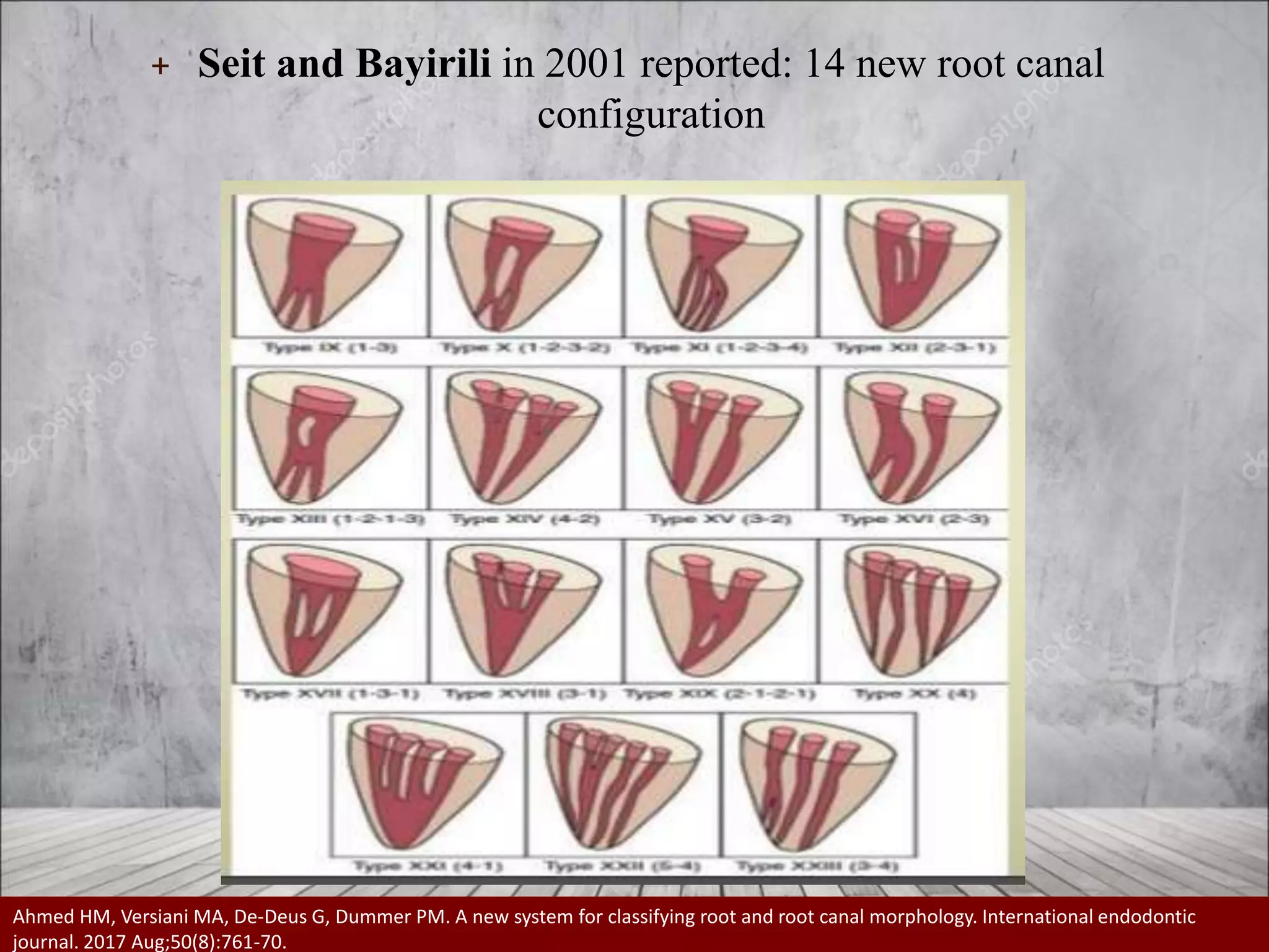 Internal anatomy of pulp space | PPT | Dental Health | Diseases and ...