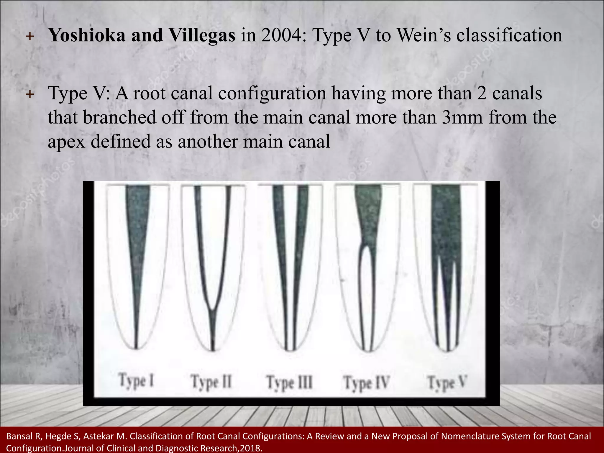 Internal anatomy of pulp space | PPT