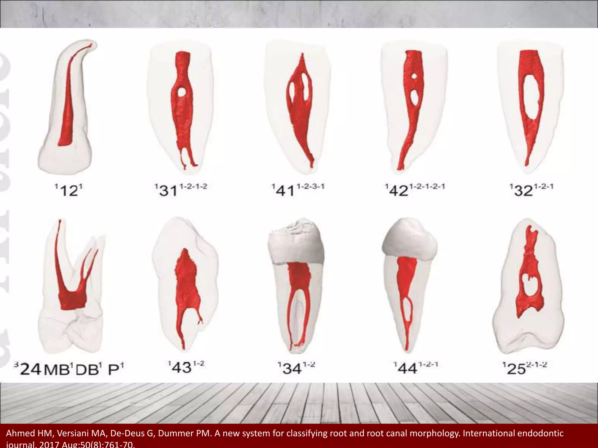 Internal anatomy of pulp space | PPT