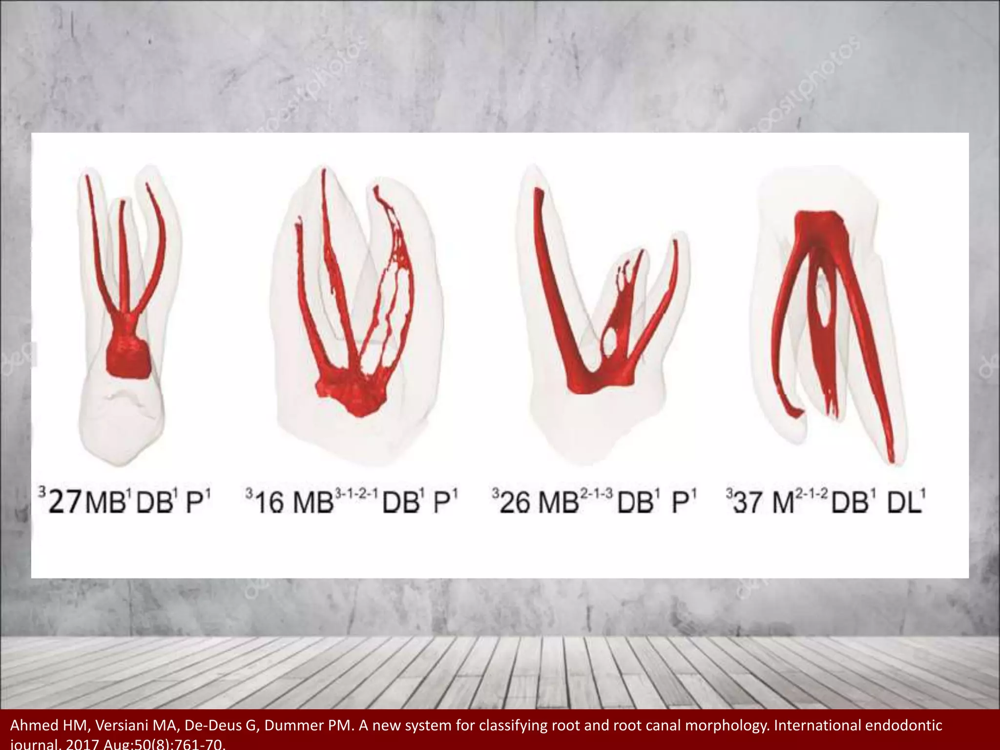 Internal anatomy of pulp space | PPT | Dental Health | Diseases and ...