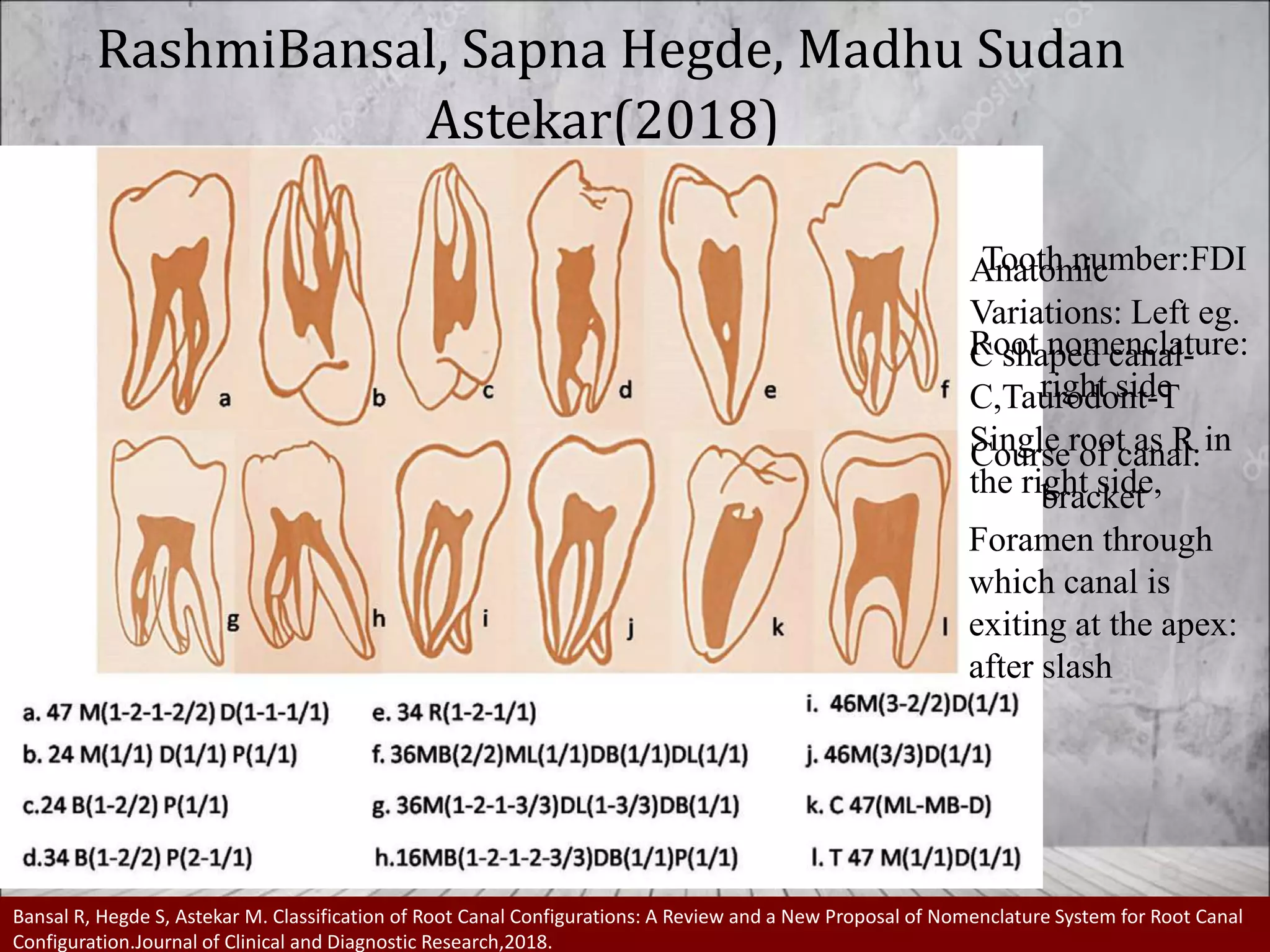 Internal anatomy of pulp space | PPT | Dental Health | Diseases and ...