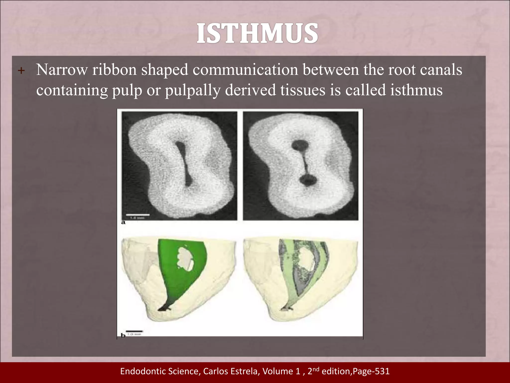 Internal anatomy of pulp space | PPT