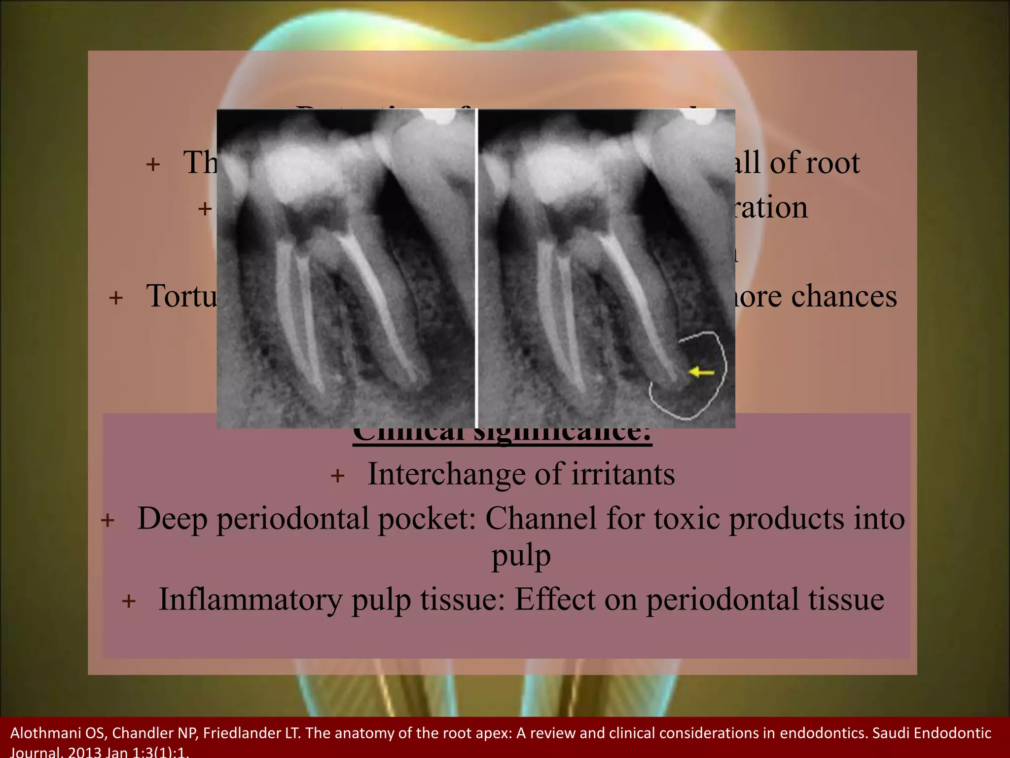 Internal anatomy of pulp space | PPT