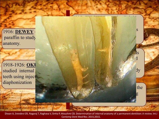 Internal anatomy of pulp space | PPT | Dental Health | Diseases and ...