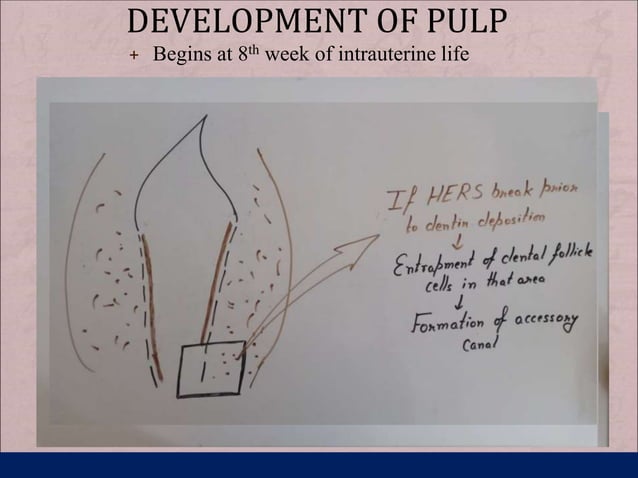 Internal anatomy of pulp space | PPT | Dental Health | Diseases and ...