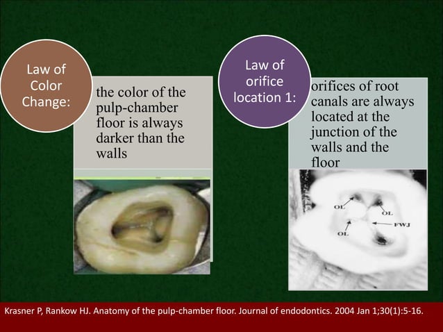 Internal anatomy of pulp space | PPT | Dental Health | Diseases and ...