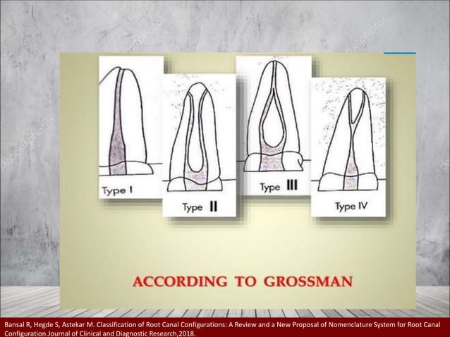 Internal anatomy of pulp space | PPT | Dental Health | Diseases and ...