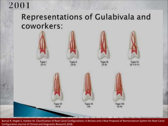 Internal anatomy of pulp space | PPT | Dental Health | Diseases and ...