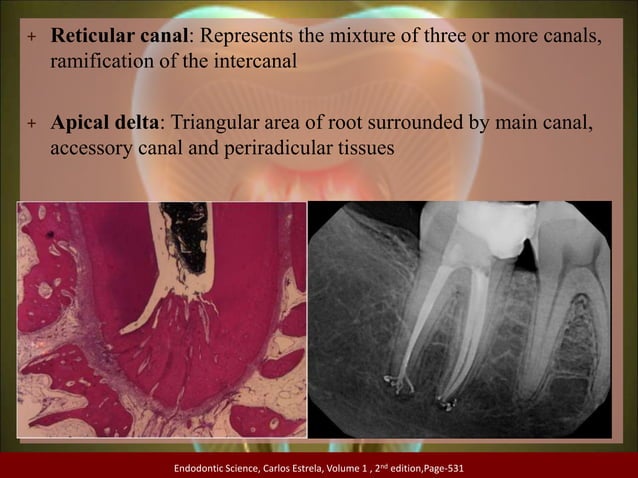 Internal anatomy of pulp space | PPT | Dental Health | Diseases and ...