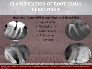 Internal anatomy of pulp space | PPT