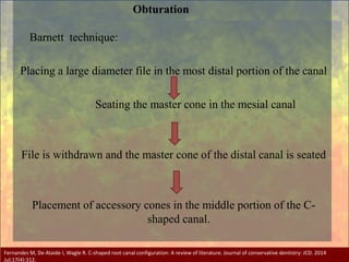 Internal anatomy of pulp space | PPT