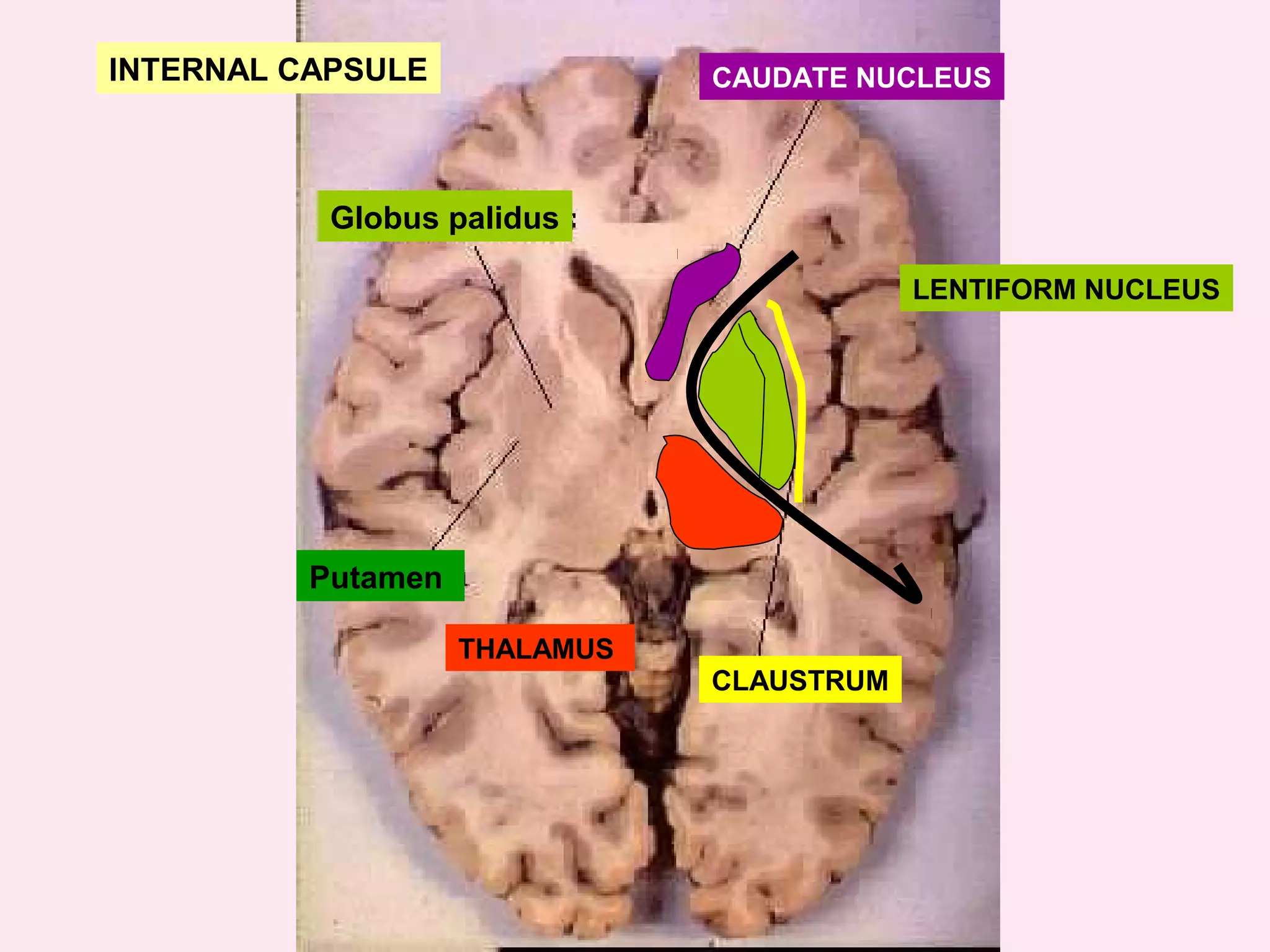 Internal capsule | PPT