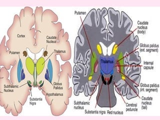 Internal capsule | PPT | Brain and Nervous System Disorders | Diseases ...